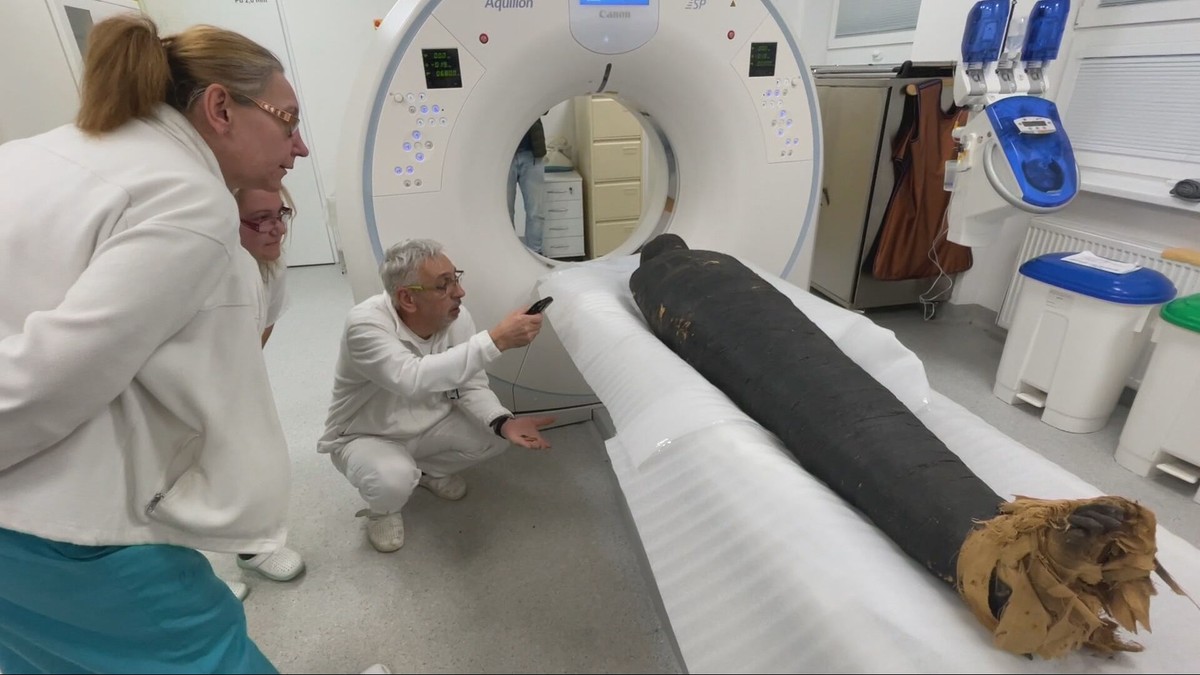 V nemocnici v Rimavskej Sobote absolvovala CT vyšetrenie 3000-ročná ...