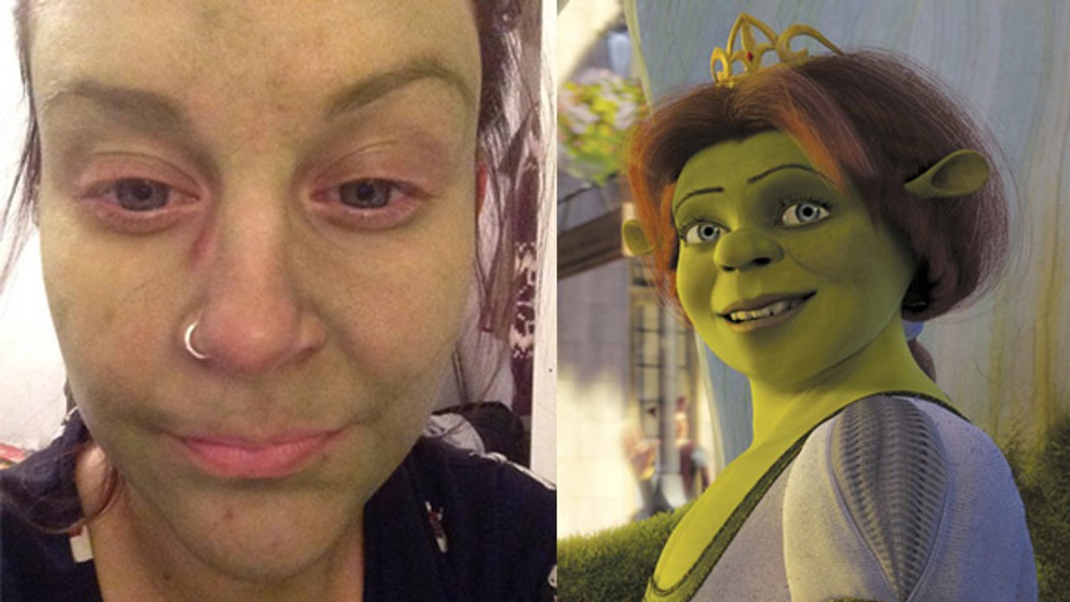 Použila samoopaľovák, skončila ako Fiona zo Shreka | TVNOVINY.sk